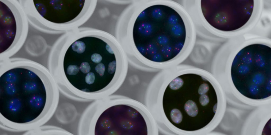 Corporate News | Keronite